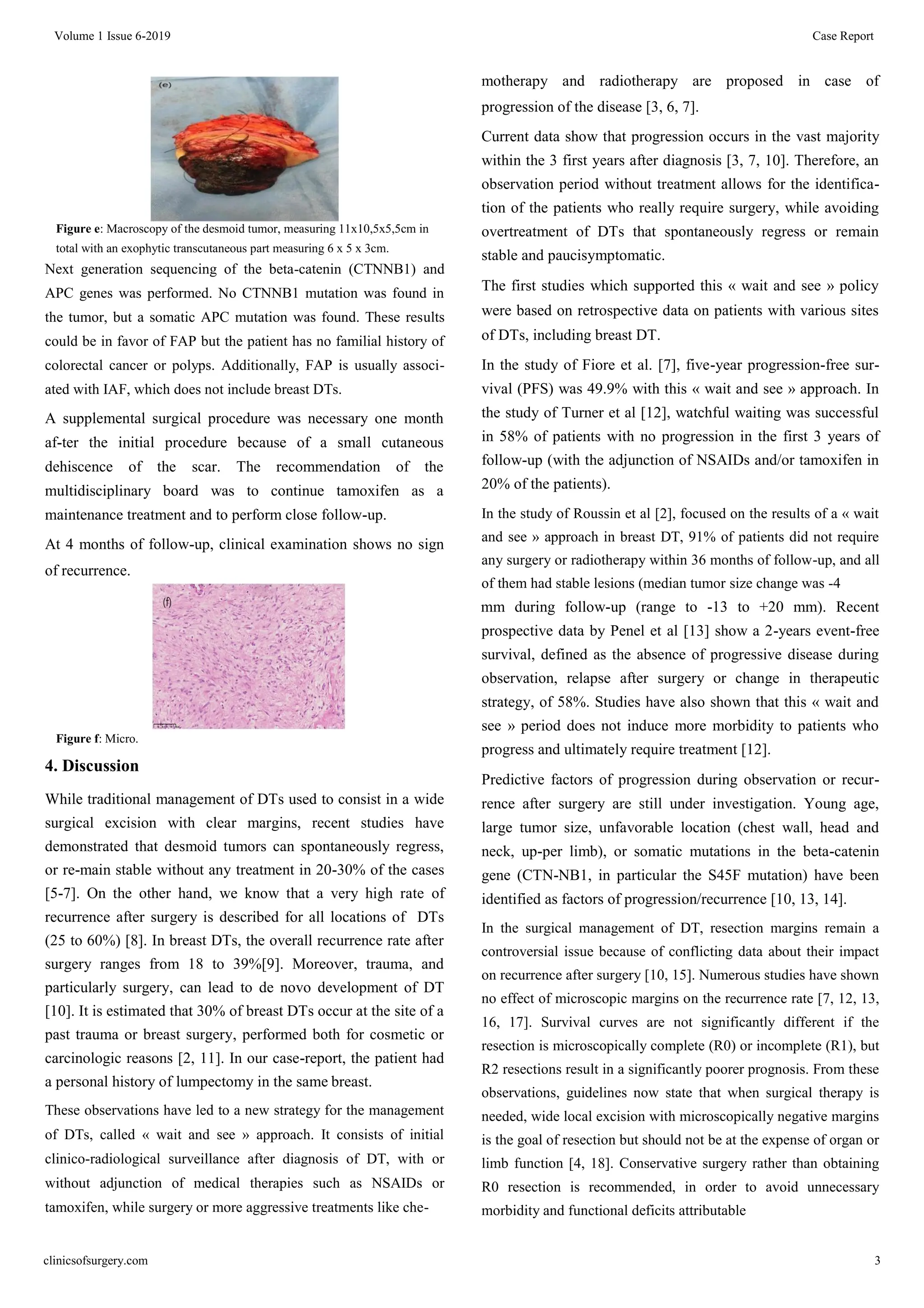 Breast Desmoid Tumor with Spectacular Evolution : A Case Report and ...