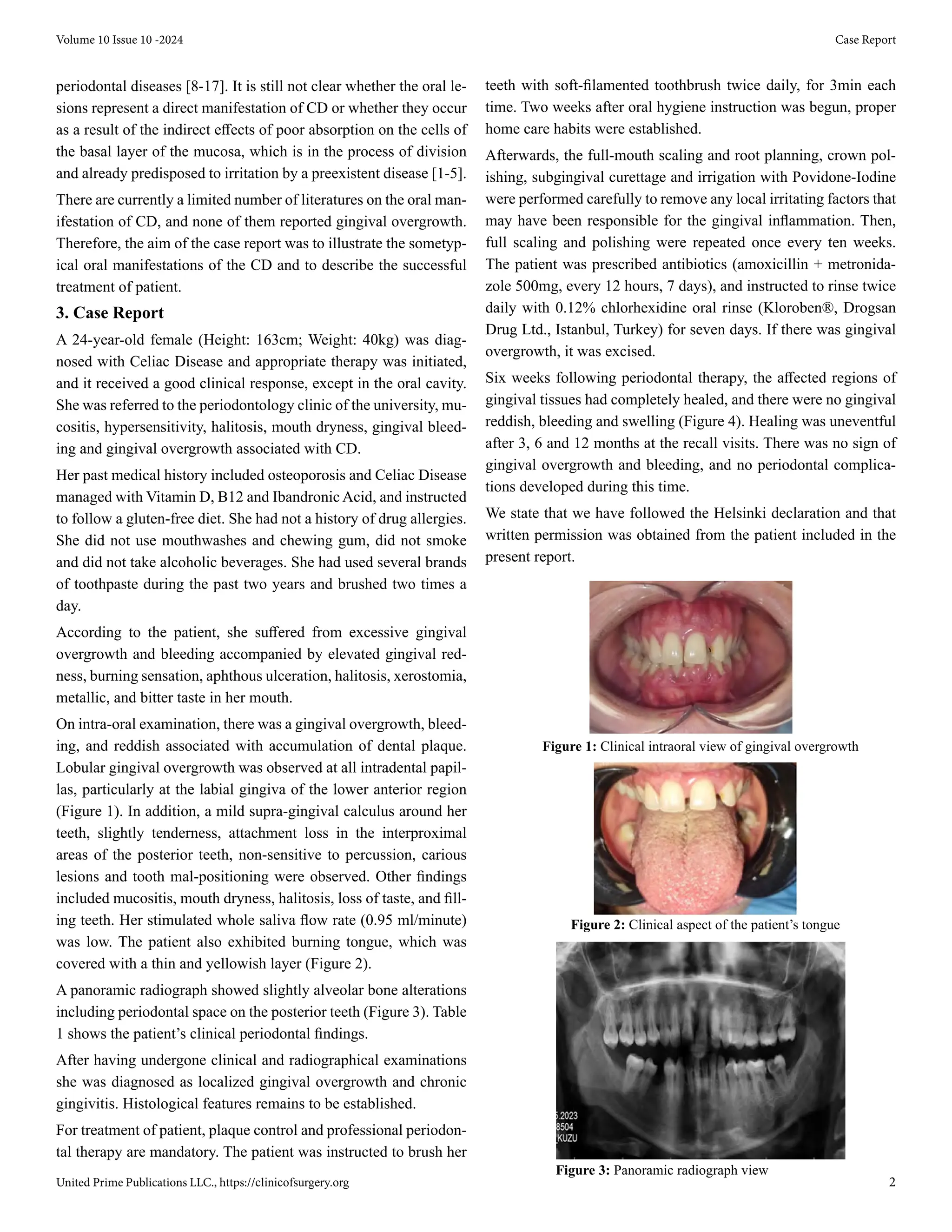 Treatment of Gingival Overgrowth in a Patient with Celiac Disease: A ...