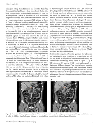 Biliary Cryptococcus Neoformans Manifesting as Obstructive Jaundice ...