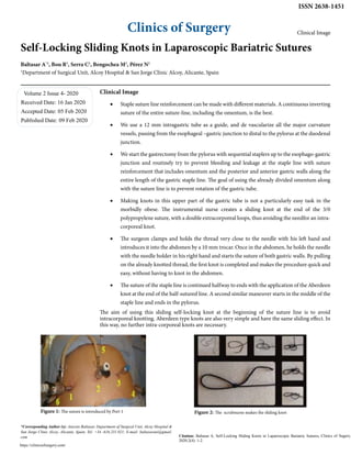 Self-Locking Sliding Knots in Laparoscopic Bariatric Sutures | PDF