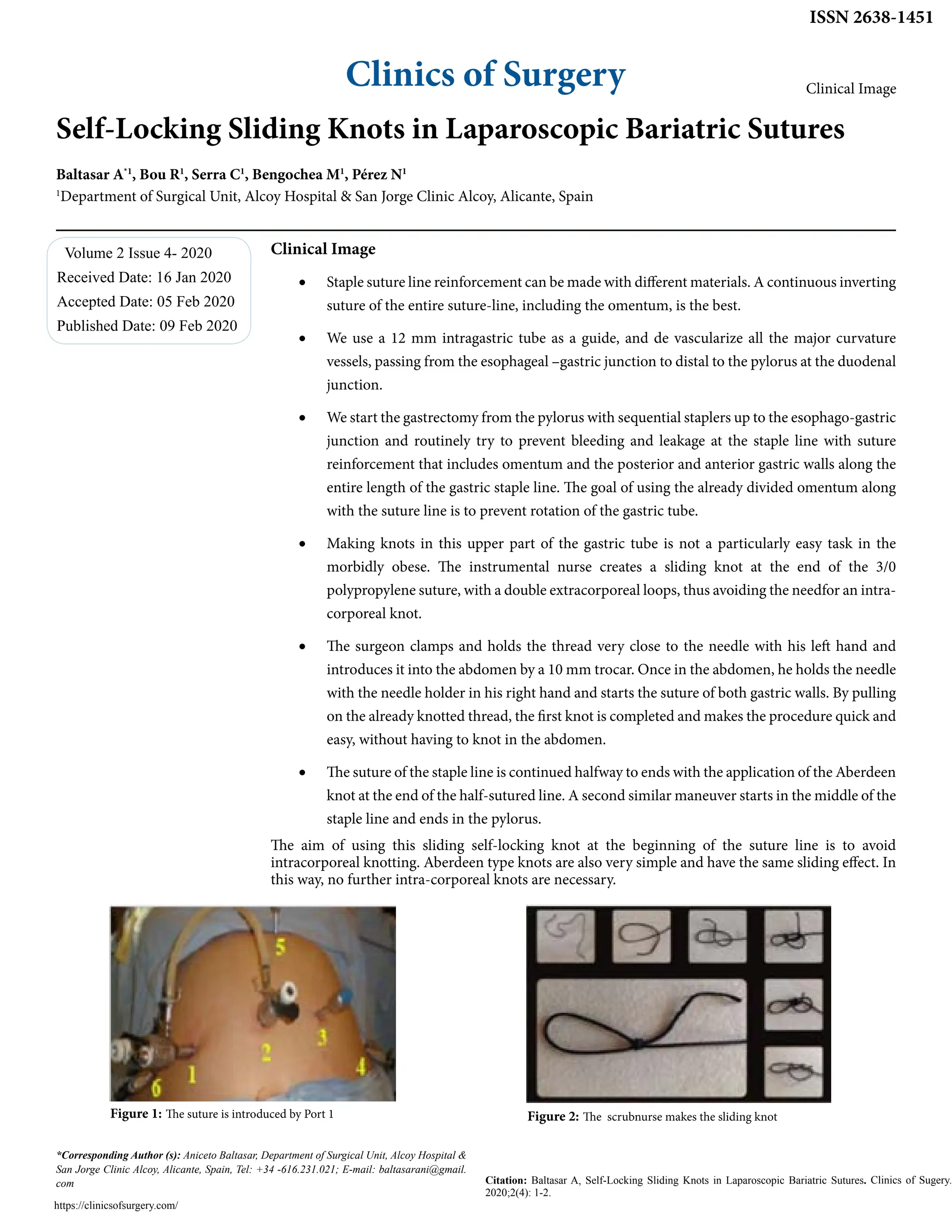 Self-Locking Sliding Knots in Laparoscopic Bariatric Sutures | PDF