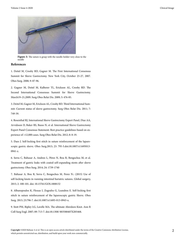 Self-Locking Sliding Knots in Laparoscopic Bariatric Sutures | PDF