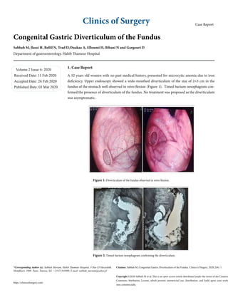 Congenital Gastric Diverticulum of the Fundus | PDF