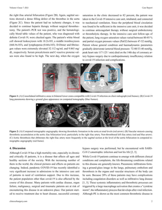 COVID-19 Infection Occurring in The Postoperative Period in A Patient ...