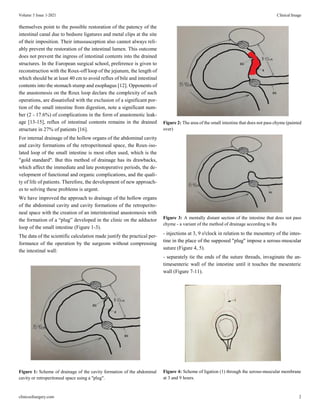 Method for the Formation of a Reflux Pancreatojejunostomy | PDF