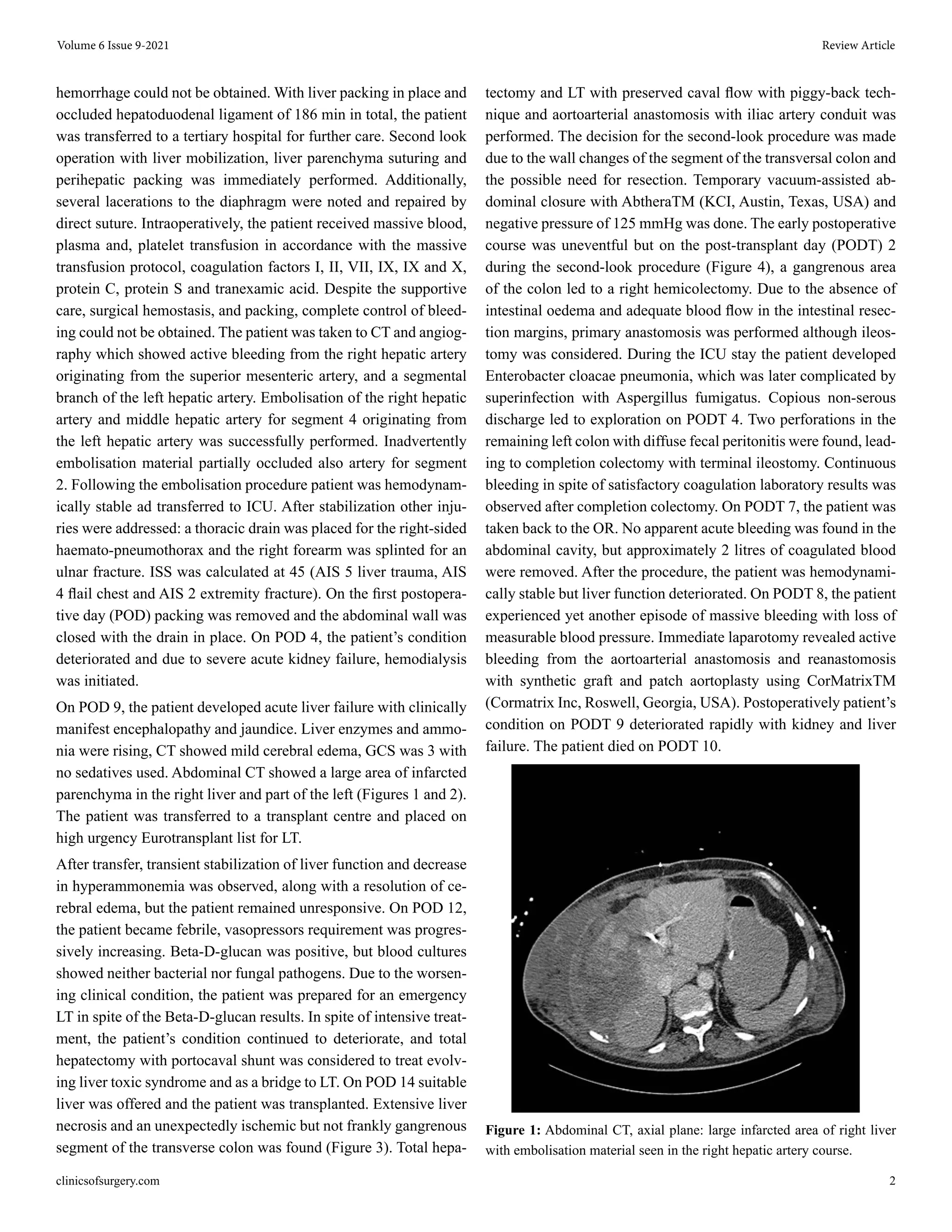 Liver Transplantation for Hepatic Trauma: Case Report and Literature ...