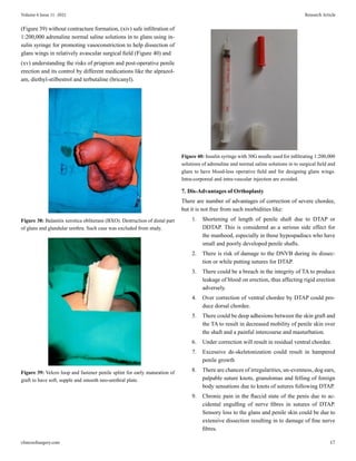The Hypospadias, Chordee, Orthoplasty and The Prepucial Hood | PDF