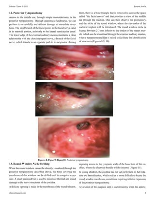 Surgical Technique of Cochlear Implantation: An Update | PDF