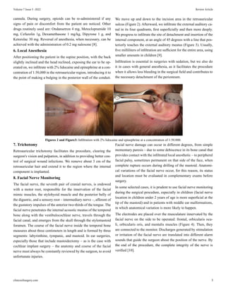 Surgical Technique of Cochlear Implantation: An Update | PDF