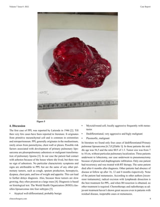 Rare Case Of Primary Pulmonary Dedifferentiated Liposarcoma | PDF