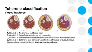 Close soft tissue injuries in fractures.pptx