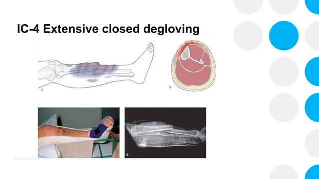 Close soft tissue injuries in fractures.pptx
