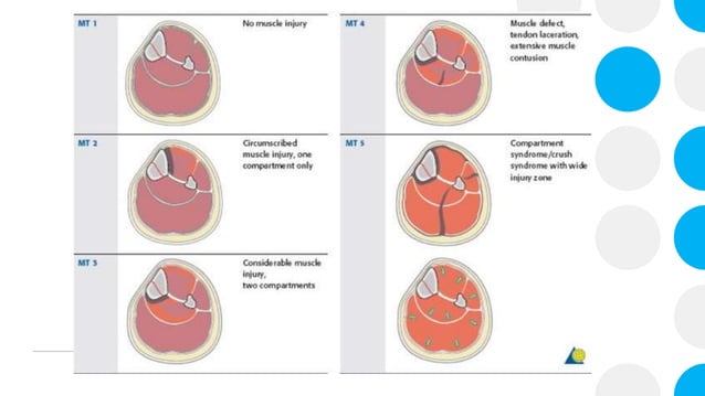 Close soft tissue injuries in fractures.pptx