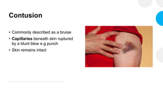Close soft tissue injuries in fractures.pptx