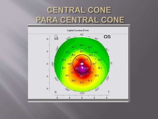 Dr. Coşkunseven "The New Keraring 340 Degree Segment" | PPTX