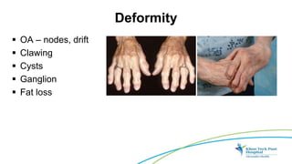 Cosmesis in hand surgery | PPT