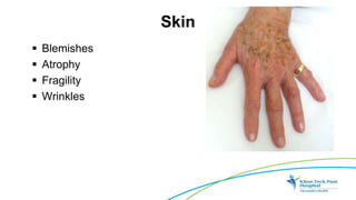 Cosmesis in hand surgery | PPT