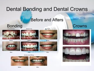 Cosmetic dentistry | PPT