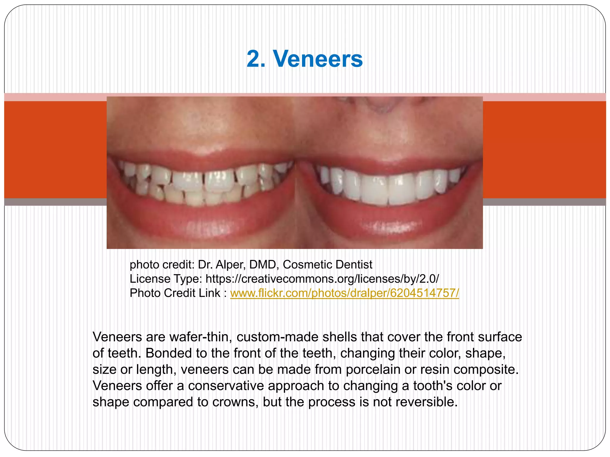 Cosmetic dentistry before and after | PPTX