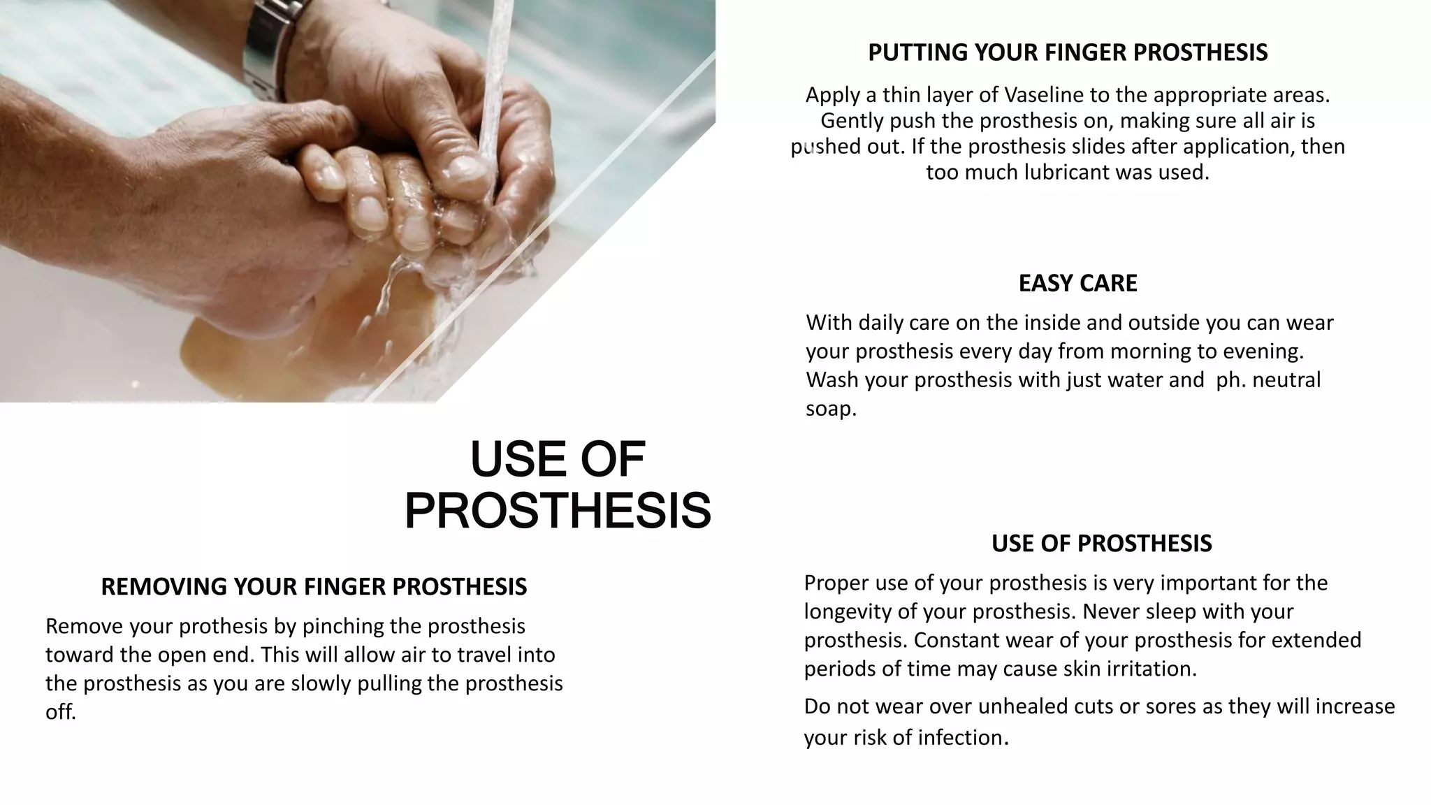 Cosmetic Restoration and silicone finger Prosthesis | PPTX