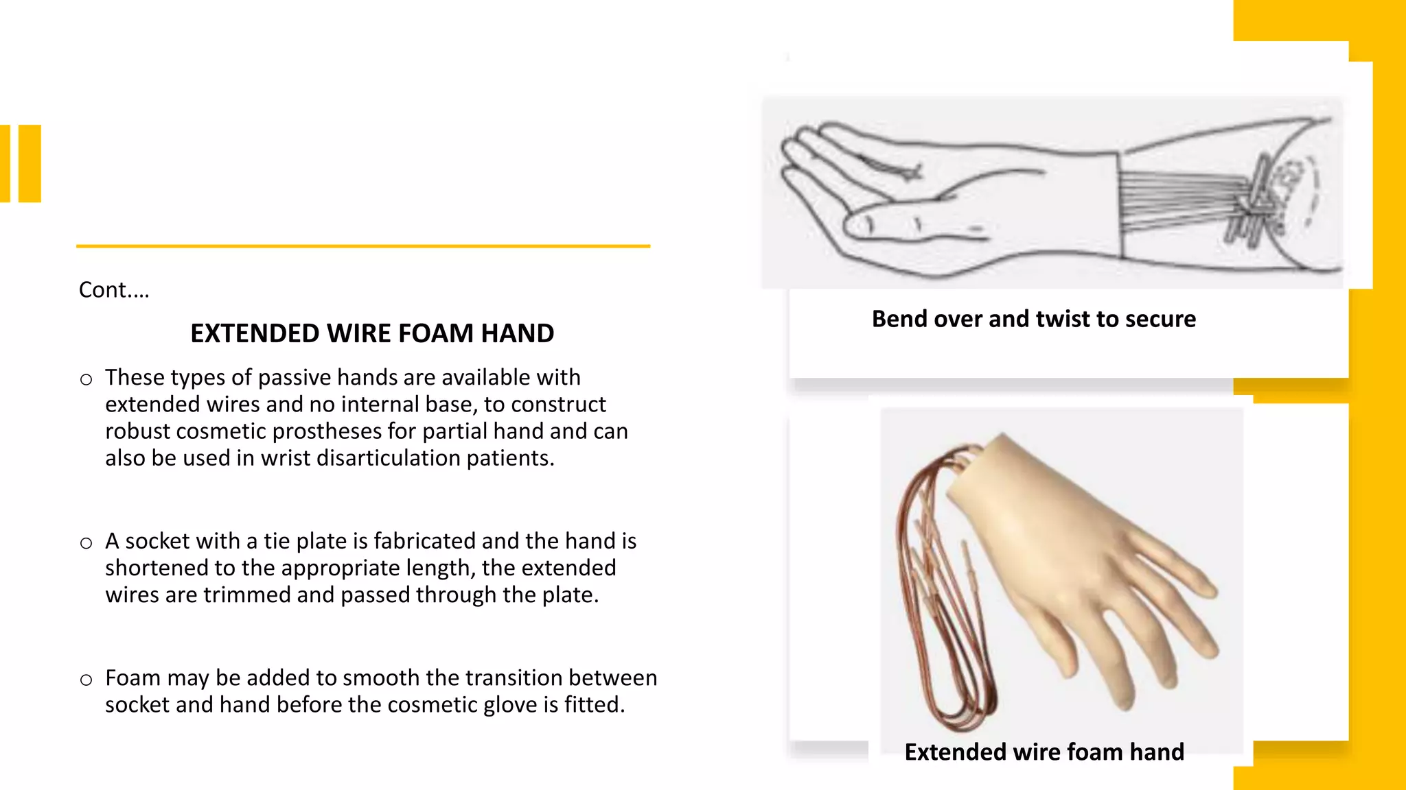 Cosmetic Restoration and silicone finger Prosthesis | PPTX