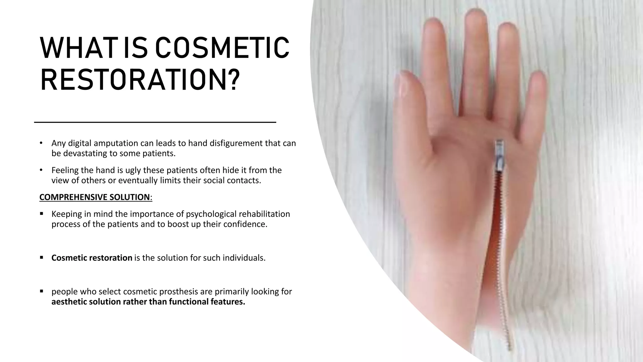 Cosmetic Restoration and silicone finger Prosthesis | PPTX