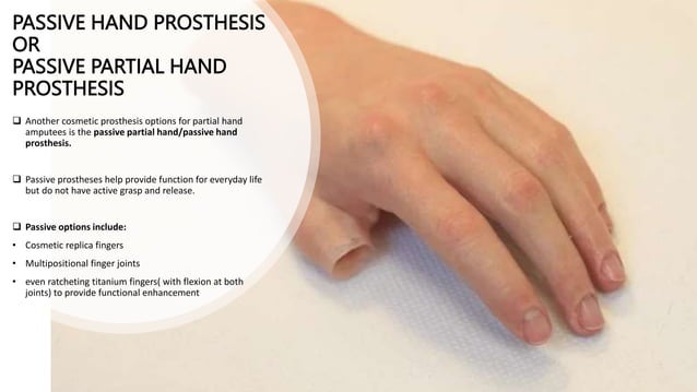 Cosmetic Restoration and silicone finger Prosthesis | PPTX | Nail Care ...