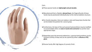 Cosmetic Restoration and silicone finger Prosthesis | PPTX