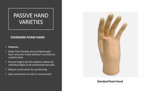 Cosmetic Restoration and silicone finger Prosthesis | PPTX