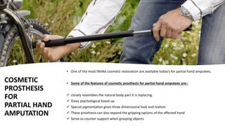 Cosmetic Restoration and silicone finger Prosthesis | PPTX