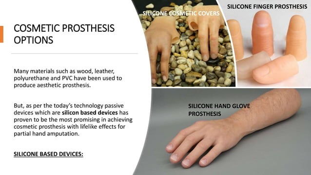 Cosmetic Restoration and silicone finger Prosthesis | PPTX | Nail Care ...