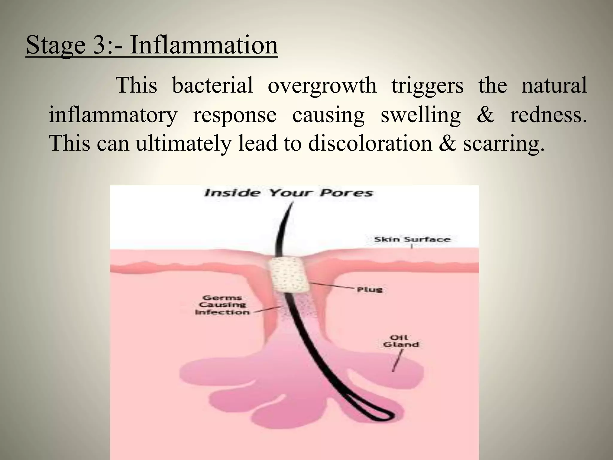 Structure of skin relating to problems like dry skin, acne vulgaris ...