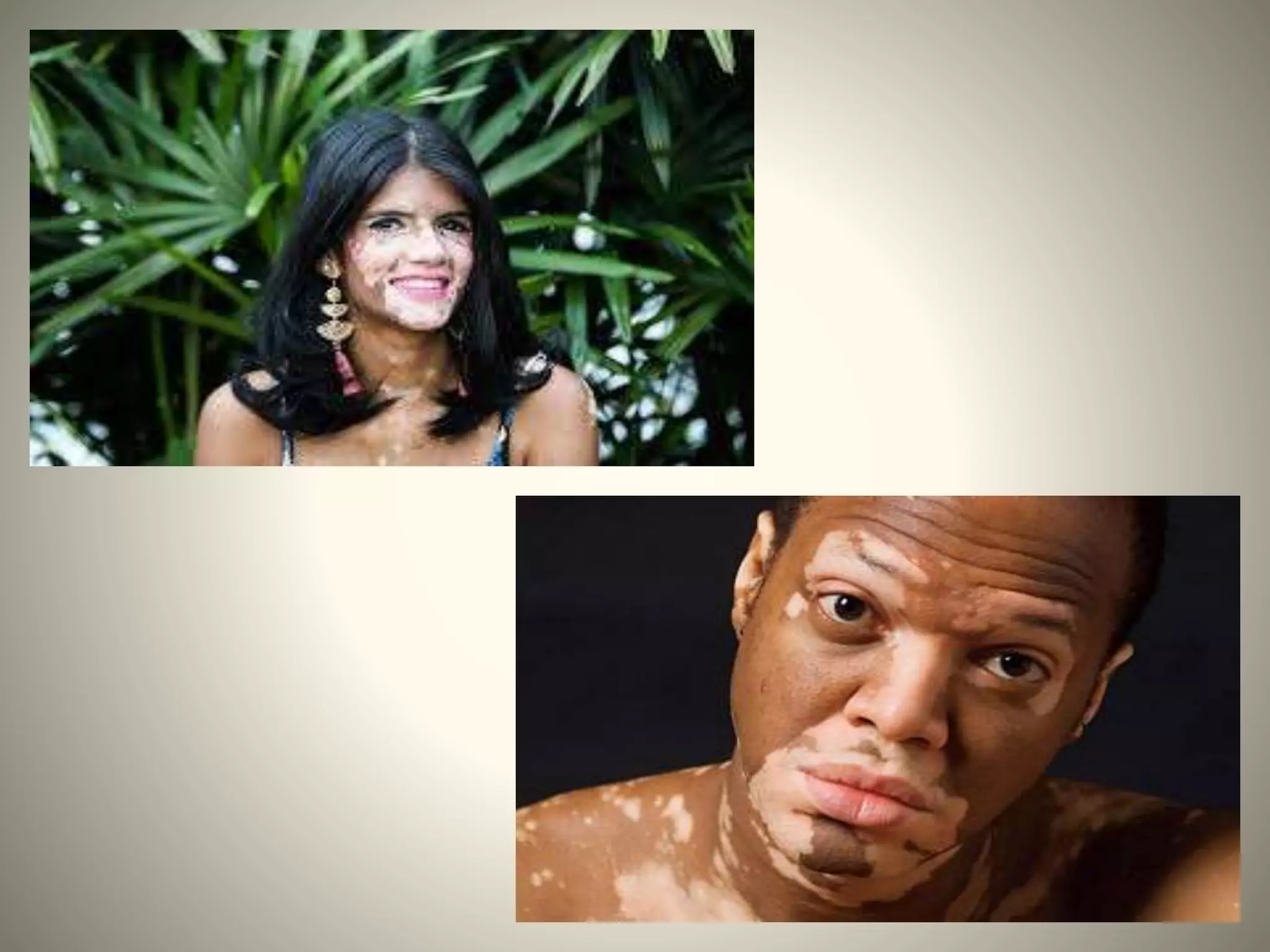 Structure of skin relating to problems like dry skin, acne vulgaris ...