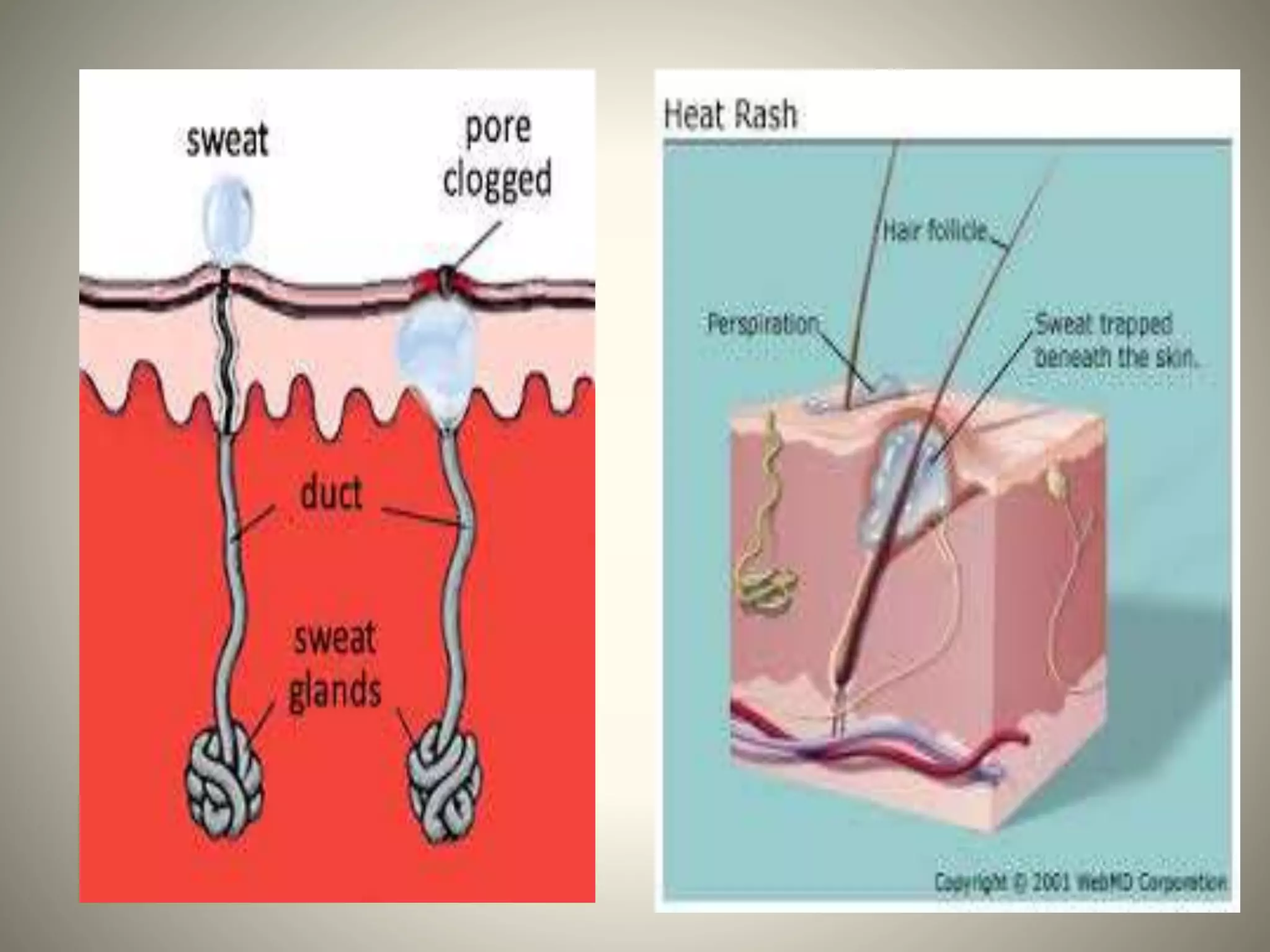 Structure of skin relating to problems like dry skin, acne vulgaris ...