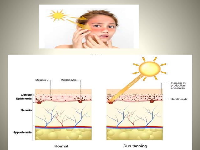 Structure of skin relating to problems like dry skin, acne vulgaris ...
