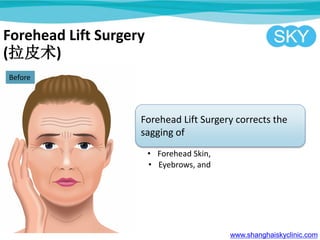 Cosmetic surgeries forehead | PPTX