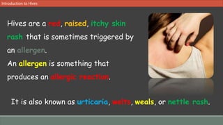 Hives( urticaria) , Cosmetology presentation , | PPTX