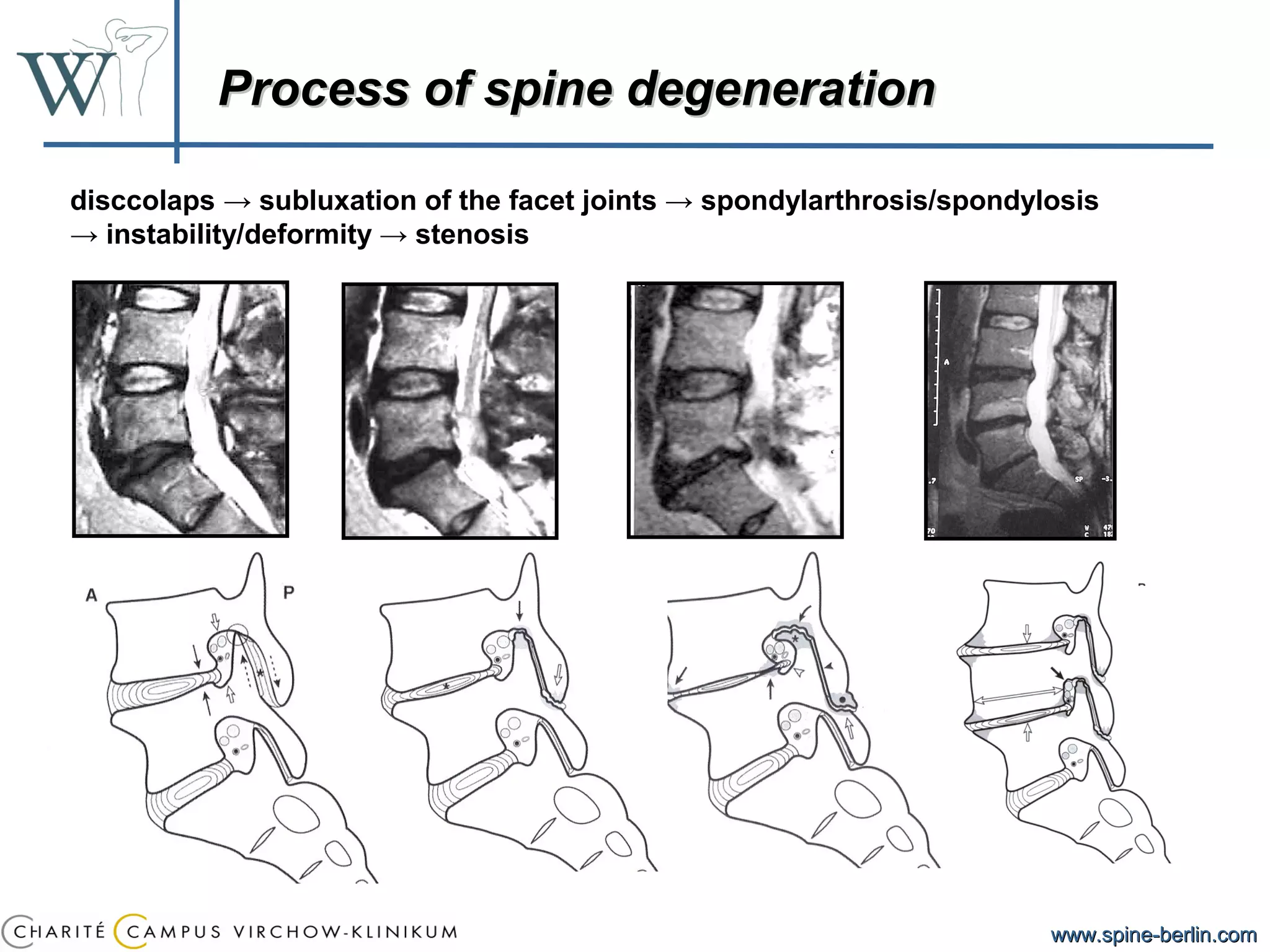 Cosmic dynamic stabilisation | PPT