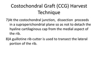 Costochondral graft in maxillofacial surgery | PPTX