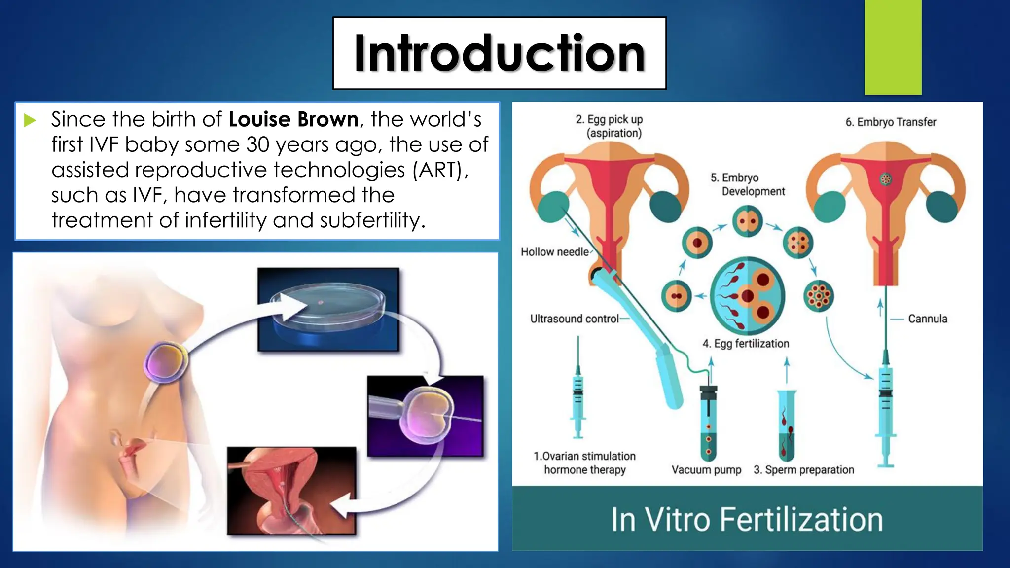 Cost of Assisted Reproductive Technology (Art) .pdf