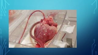 Sci9 Circulation and the Heart | PPTX