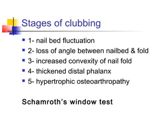 Cough & hemoptysis & cyanosis & clubbing | PPT | Blood Disorders ...