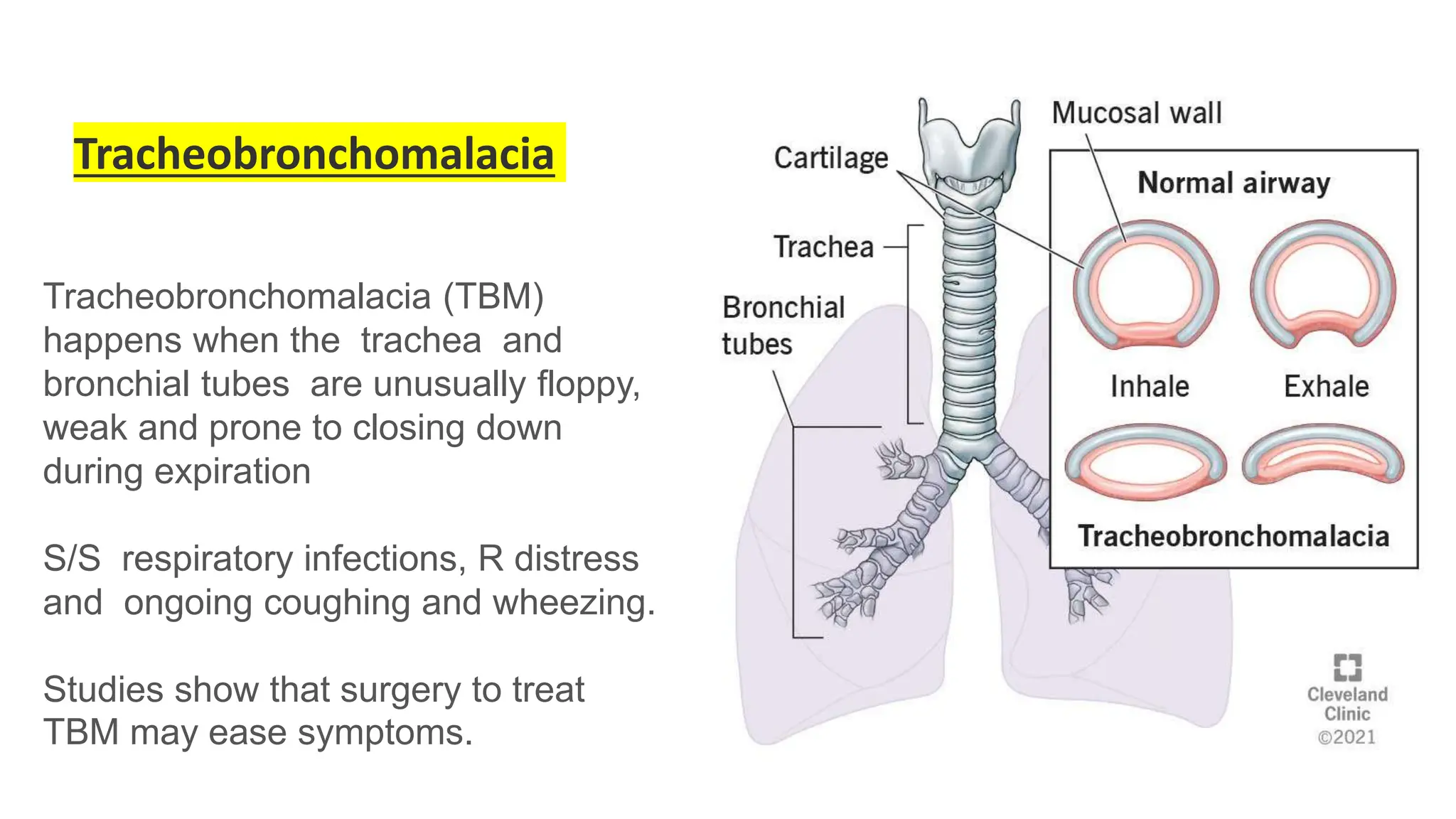 Cough in children.pptx by dr sayed ismail | PPTX