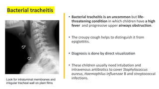 Cough in children.pptx by dr sayed ismail | PPTX