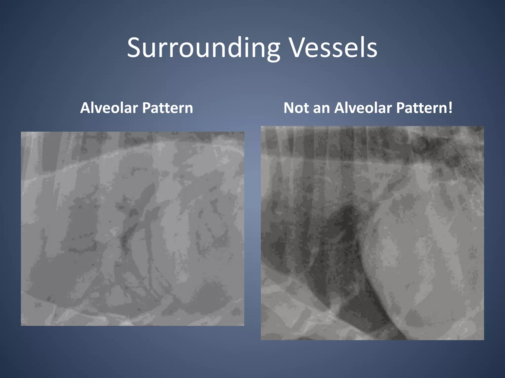 The Radiographic Approach to the Coughing Dog | PPTX