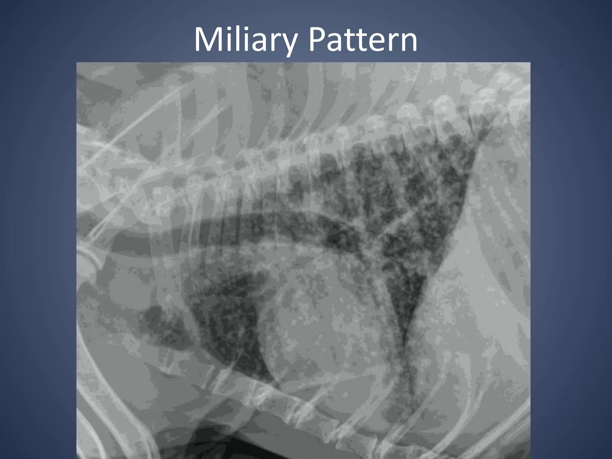 The Radiographic Approach to the Coughing Dog | PPTX