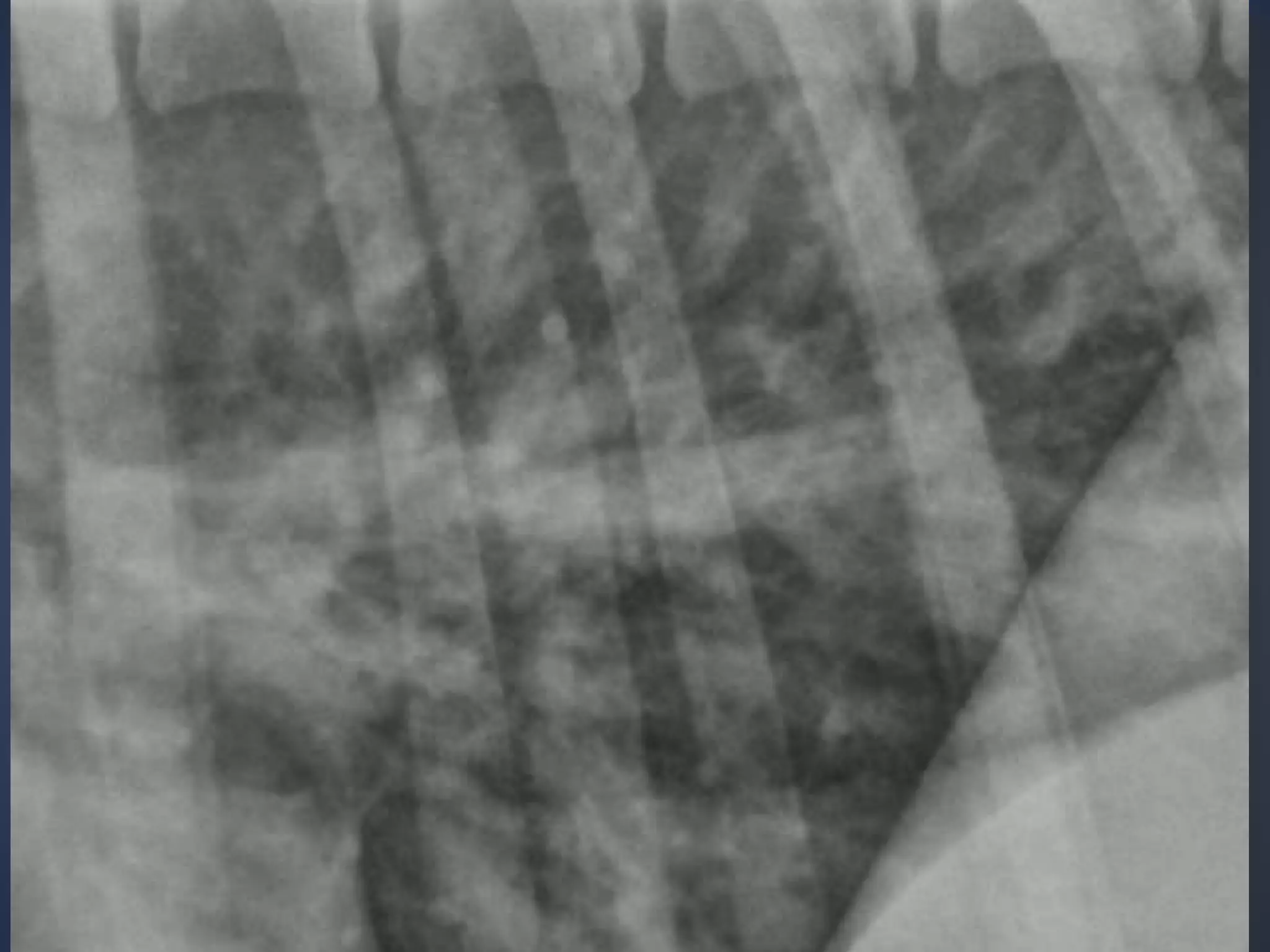 The Radiographic Approach to the Coughing Dog | PPTX
