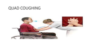 COUGHING TECHNIQUES.pptx