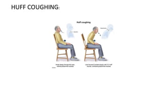 COUGHING TECHNIQUES.pptx