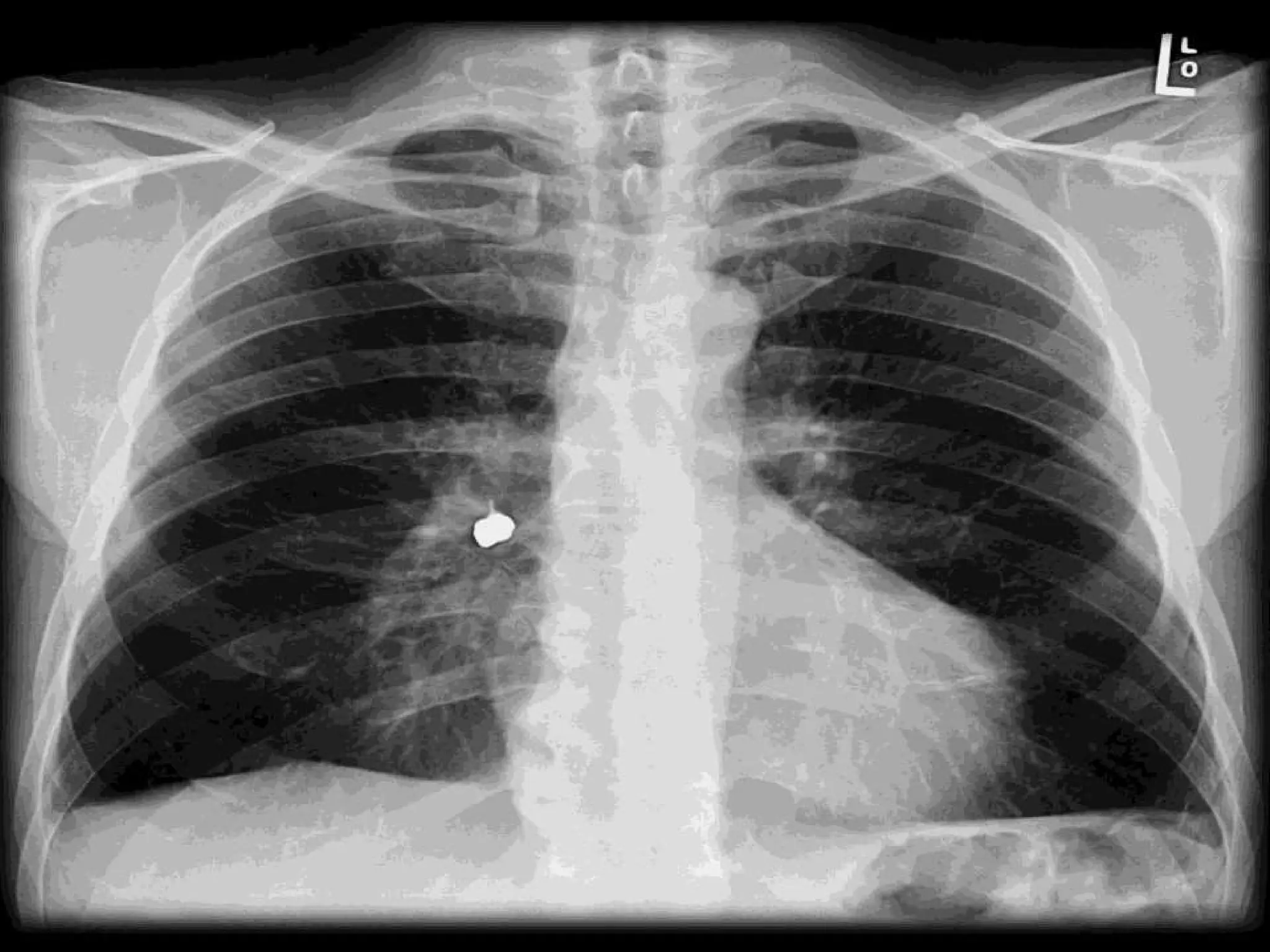 COUGH PPT mechanism and concept in physiotherapy.. | PPTX